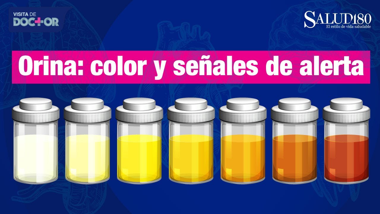 Señales de alerta por el color de la orina | Salud 180 - YouTube