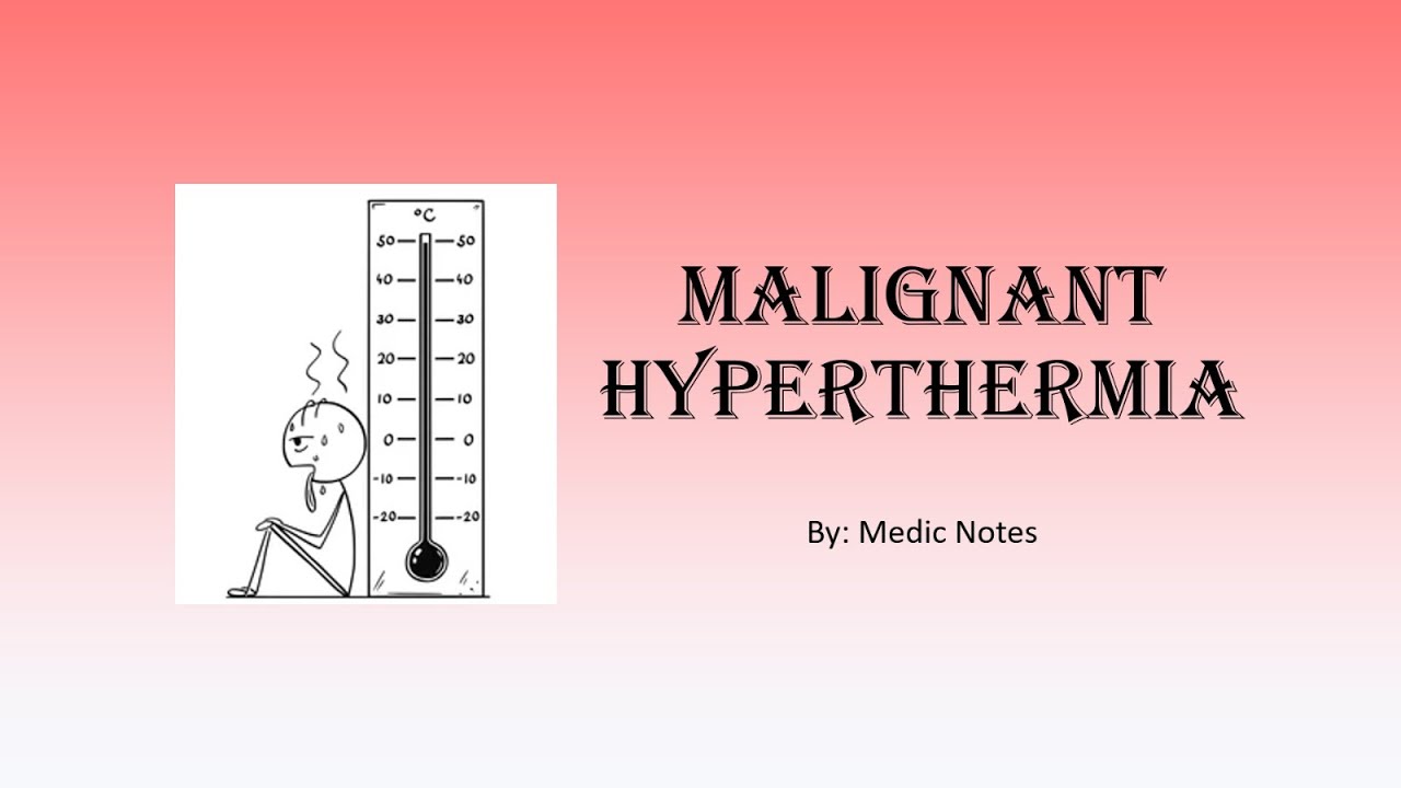Malignant hyperthermia - definition, causes, pathophysiology, signs and symptoms, treatment ...