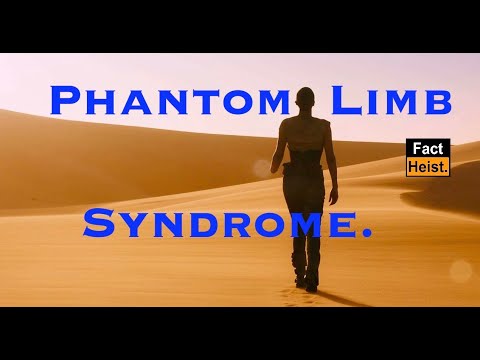 PHANTOM LIMB and PHANTOM PAIN EXPLAINED . - YouTube