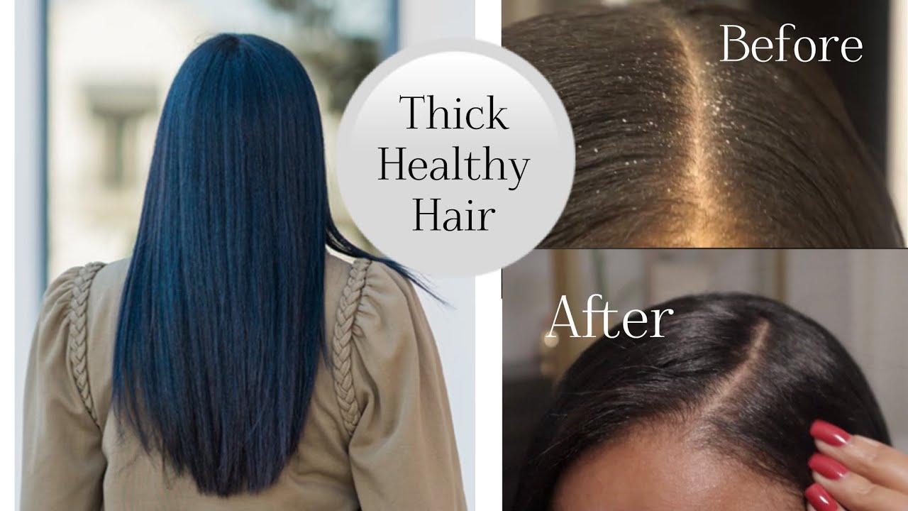 EXTREME Hair Transformation | 2025 Healthy Hair & Scalp Routine - YouTube