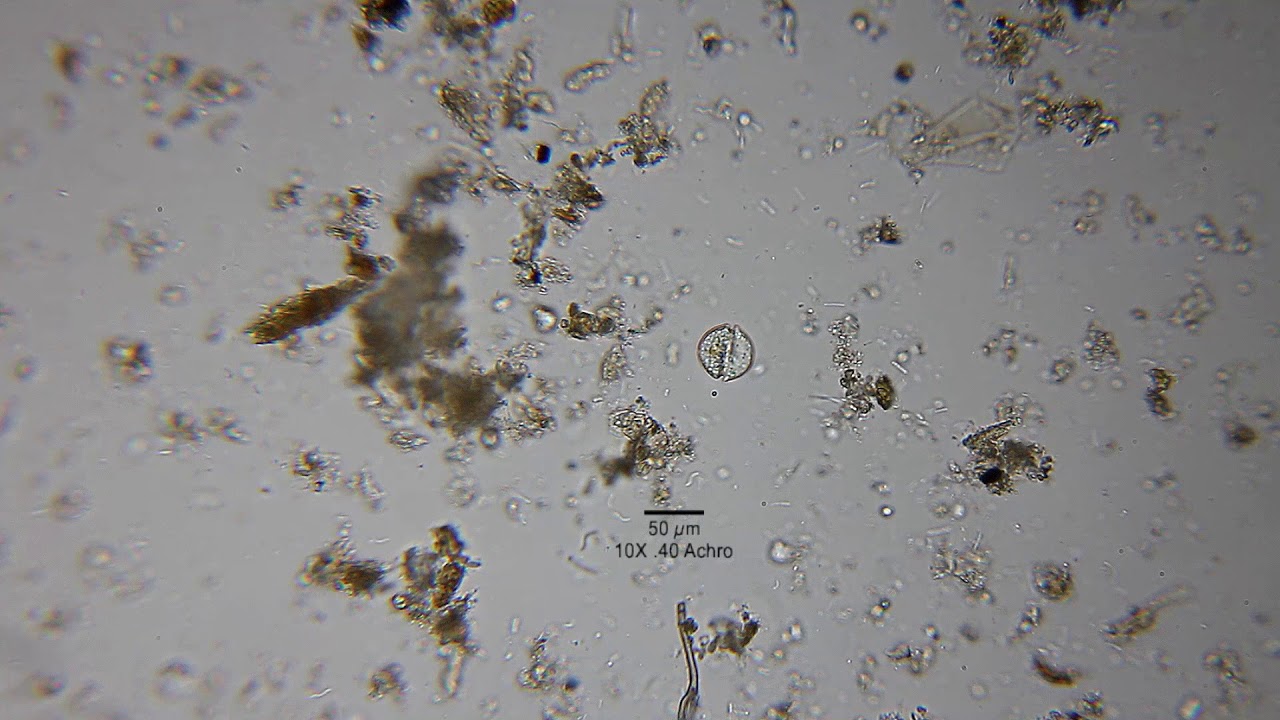 Pond Life Through the Microscope: Dinoflagellate 1 - YouTube