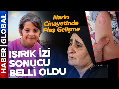 Narin Güran Cinayetinde Yeni Gelişme! Adli Tıp Raporu Ortaya Çıktı! Diş İzi Sonucu Belli Oldu