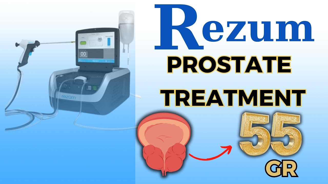 Rezum Prostate Procedure for 55 cc Prostate Volume - YouTube