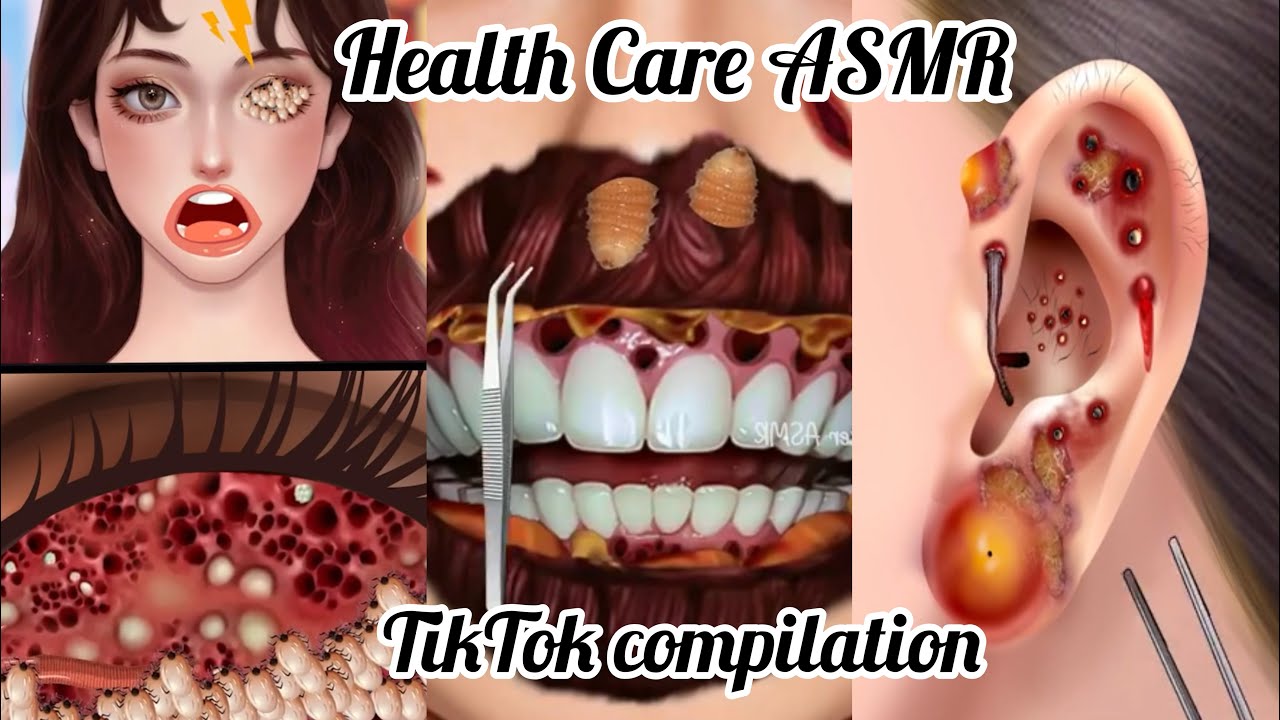 ASMR infection treatment animation so satisfying - YouTube
