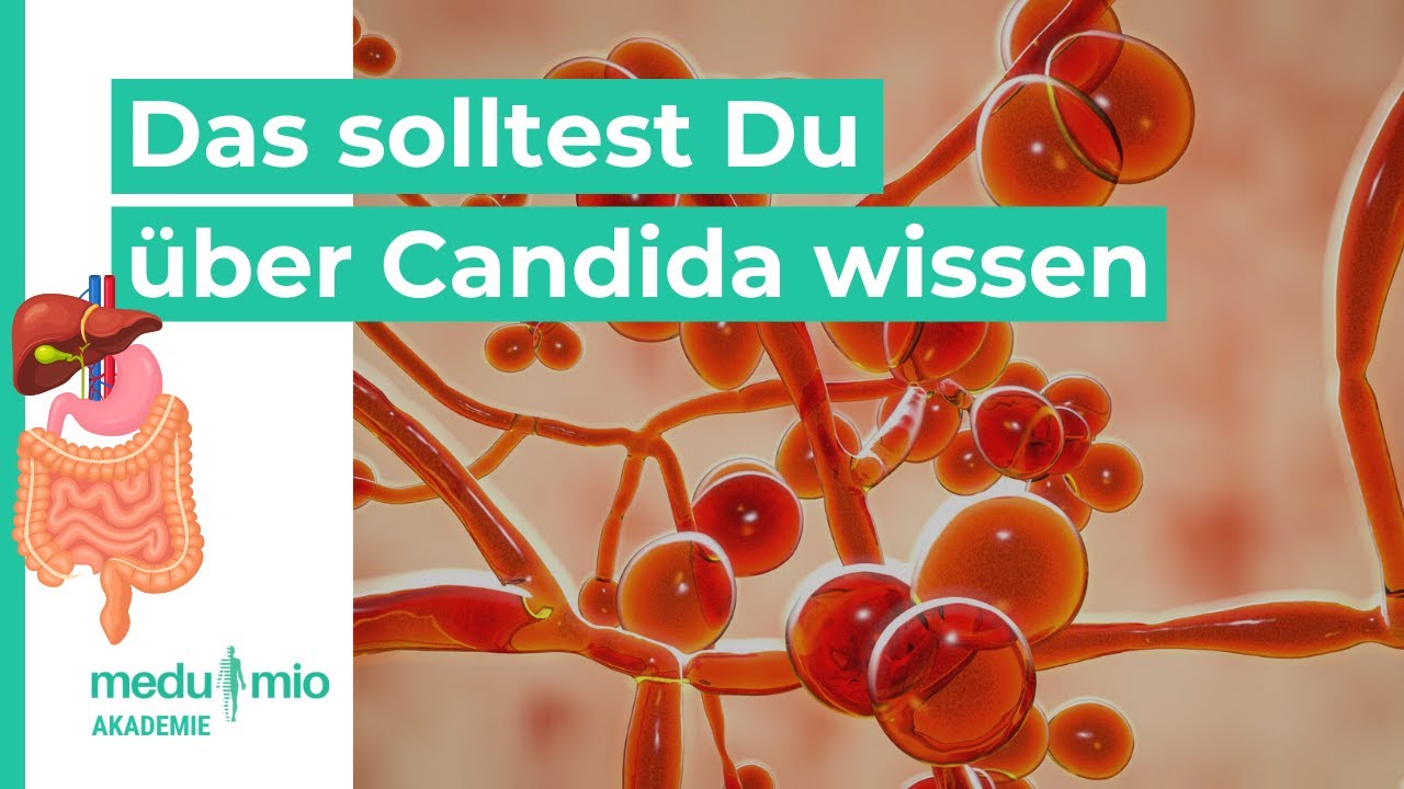 Chronische Infektionen: Das solltest Du über Candida wissen 📚 Andreas ...