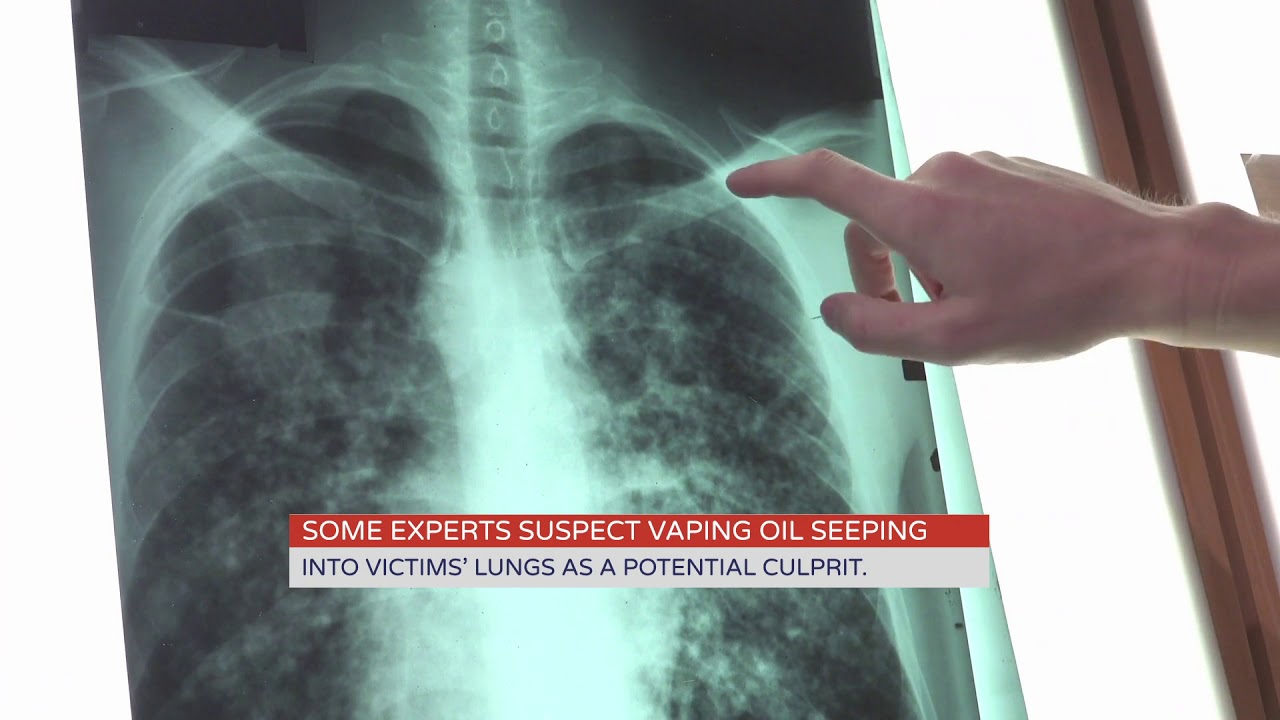 Vaping Warning from CDC - YouTube