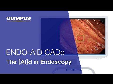 ENDO-AID CADe: The AId in Endoscopy | EVIS X1 | Gastroenterology | OLYMPUS