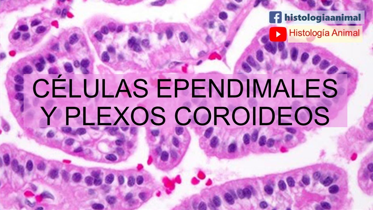 Células ependimales y plexos coroideos - Tejidos Básicos - Curso en ...