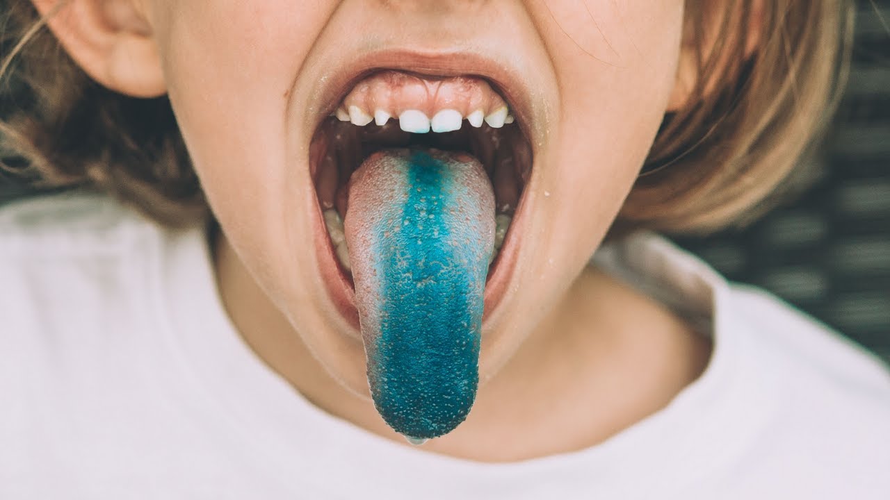 This Teen Caught Unlikely Attention When Viewers Noticed Her Blue ...