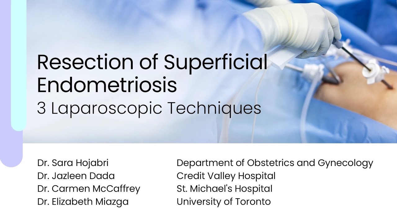 Resection of Superficial Endometriosis: 3 Laparoscopic Techniques - YouTube