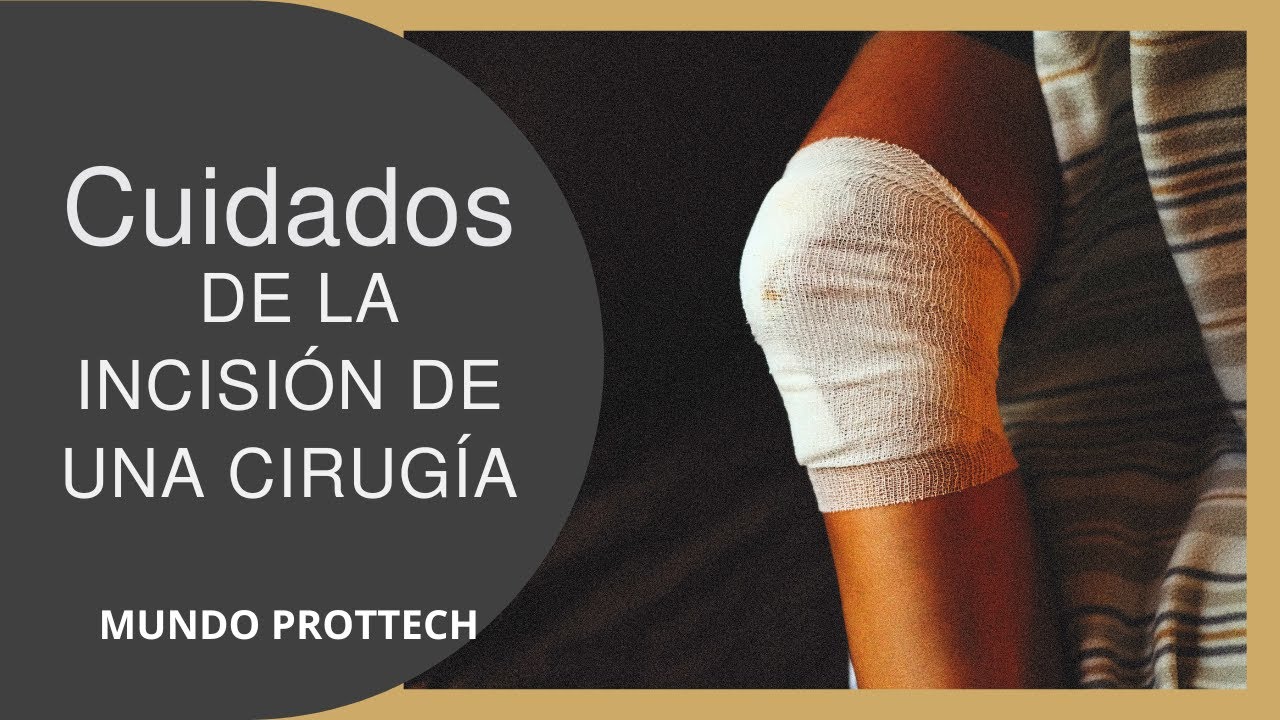 Cuidados de la incisión de una cirugía ‐ #incisión #herida #corte # ...