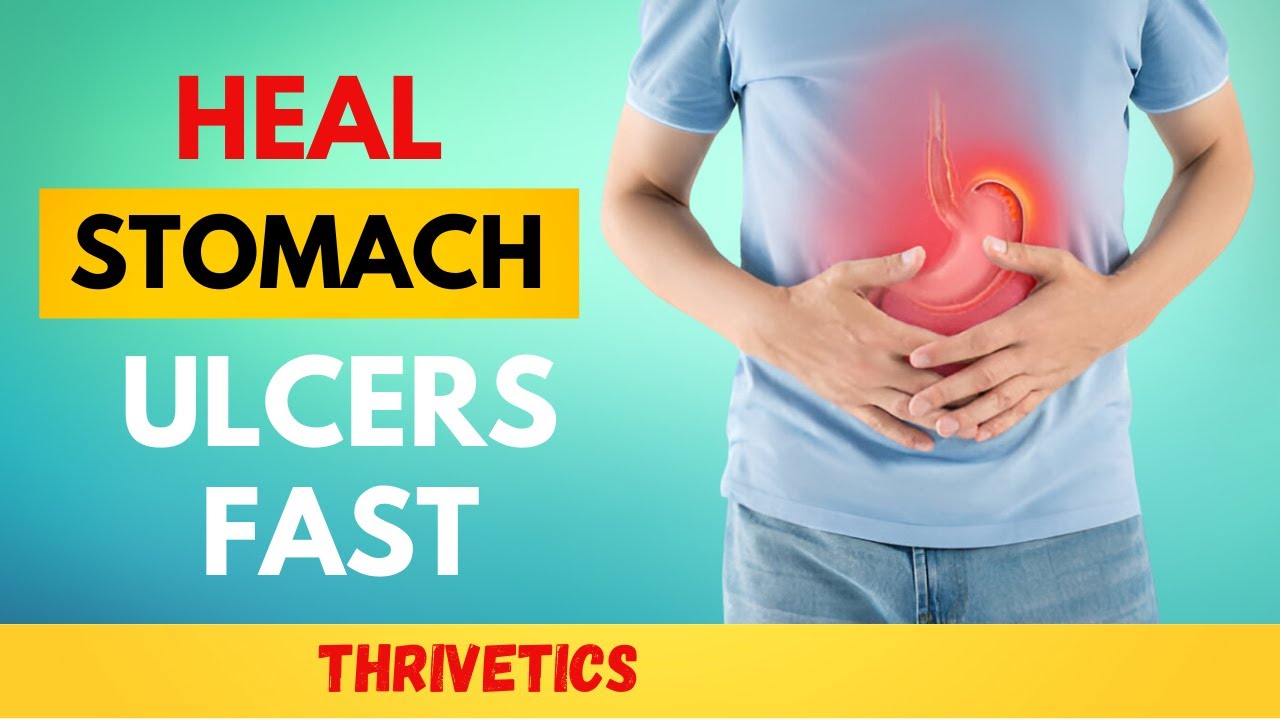 Heal Stomach Ulcers Naturally: These 5 Remedies Will Surprise You - YouTube