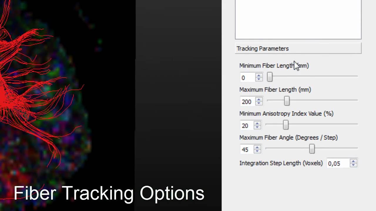 DTITool Tutorials - 04 - Fiber Tracking - YouTube
