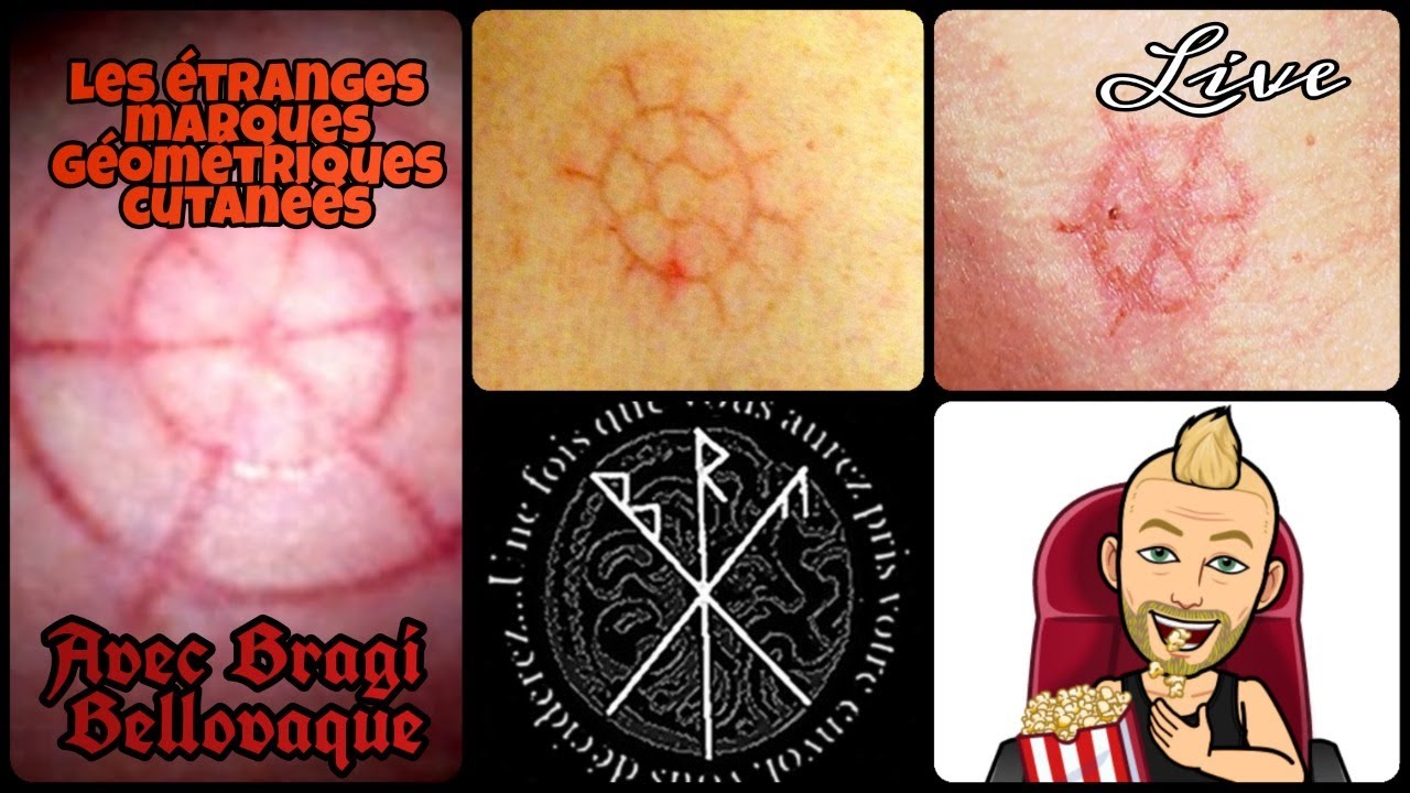 Les étranges marques géométriques cutanées avec Bragi Bellovaque et un ...
