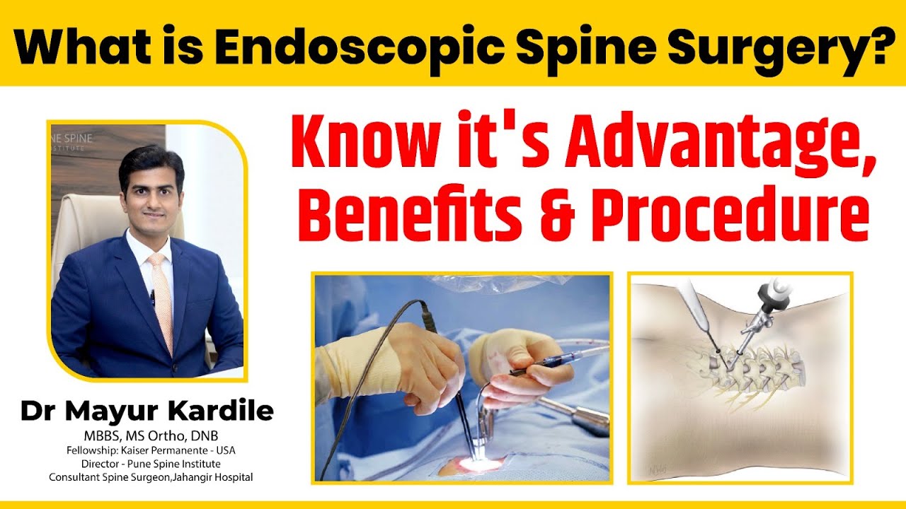What is Endoscopic Spine Surgery? Know its Advantages, Benefits ...
