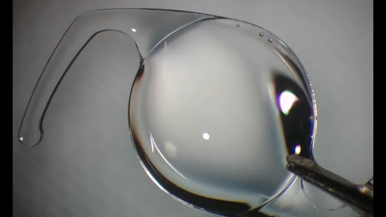 ADTEC COMFORT IOL; LONG TERM REVIEW; CATARACT LENS OPTION - YouTube
