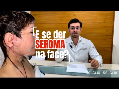 O que é seroma? E se der Seroma na face? - YouTube