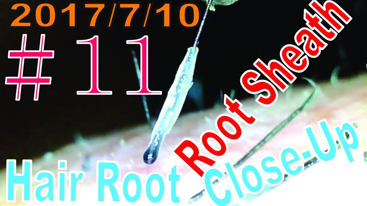 Hair Root / Root Sheath Close Up ＃11【 No Loss Root Sheath】 - YouTube