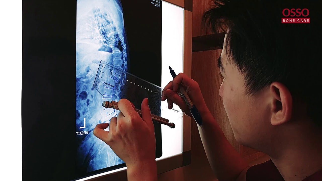 Unique X-Ray Marking Method - Chiropractic Technique - YouTube