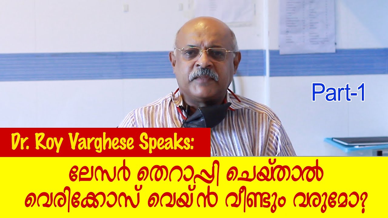 Dr Roy Varghese speaks most commonly asked questions about Varicose ...
