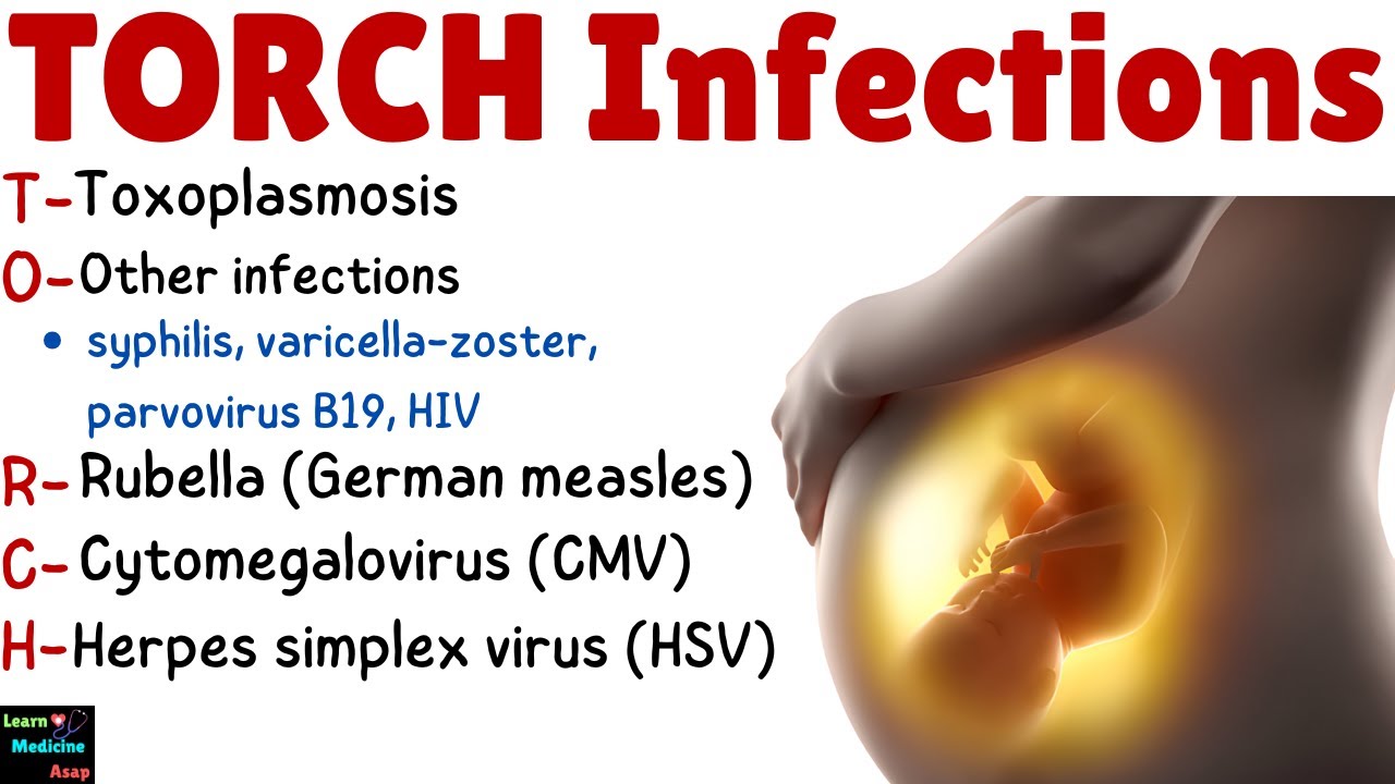 TORCH Infections: Causes, Risks, Symptoms, Diagnosis & Treatment ...