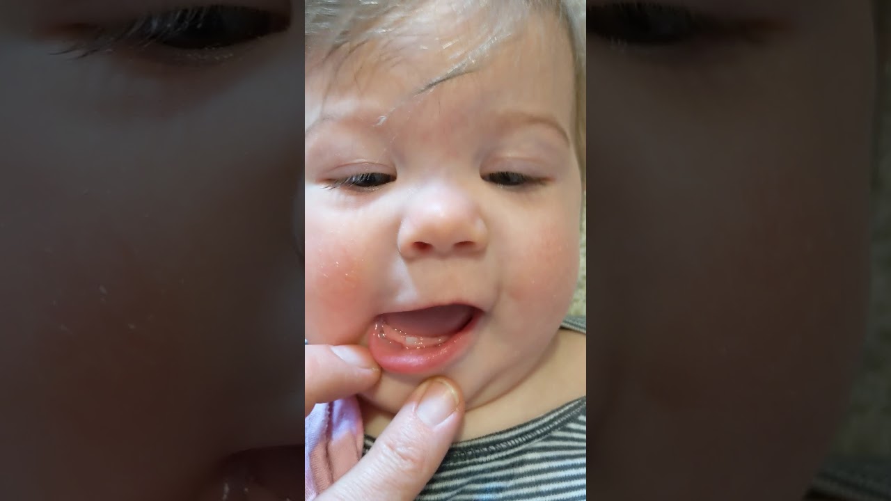 The tooth! Yay! - YouTube