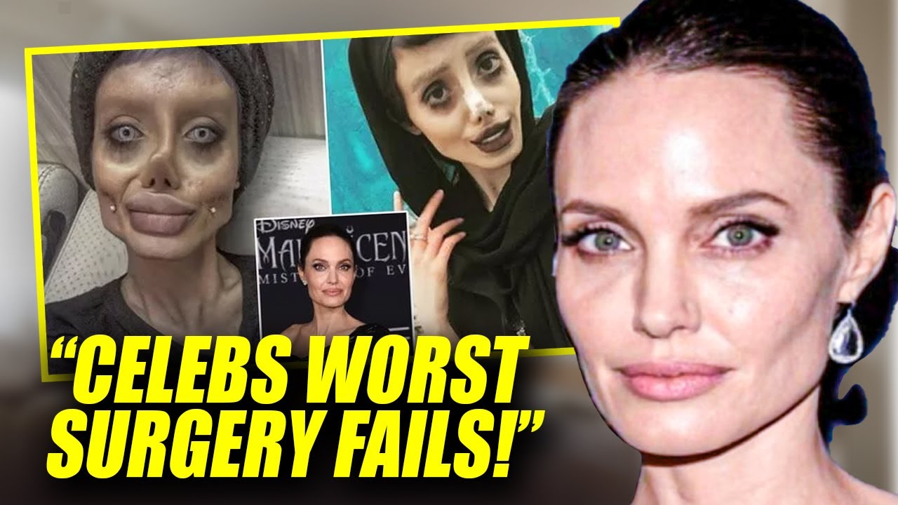 Celebs With The BIGGEST Plastic Surgery DISASTERS! Then And Now - YouTube