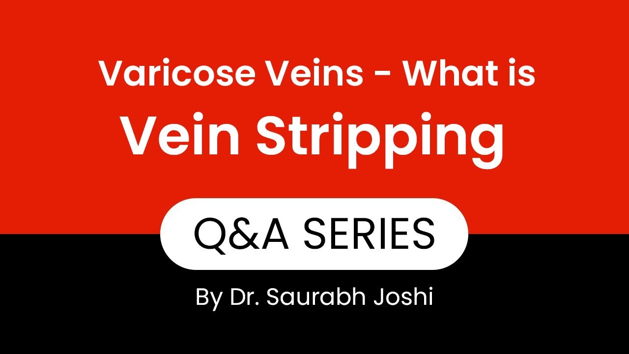 Q&A Series 1 Episode 13 - What is Varicose Veins Stripping Procedure? # ...