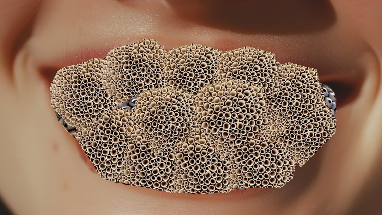 😢Infected Lips By Seeds & Ticks Treatment Asmr Animation | Trypophobia ...