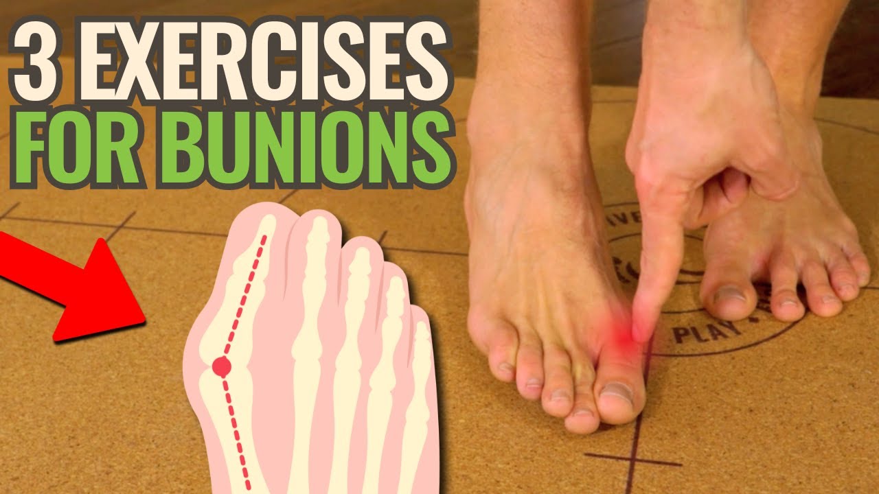 5 Minute Bunion Routine | 3 Essential Exercises - YouTube