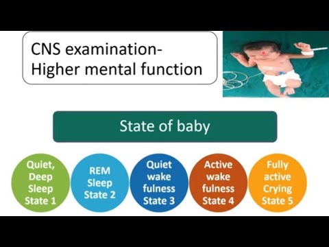 CNS Examination in Newborn | Newborn Examination (Part-8) | Pediatrics ...