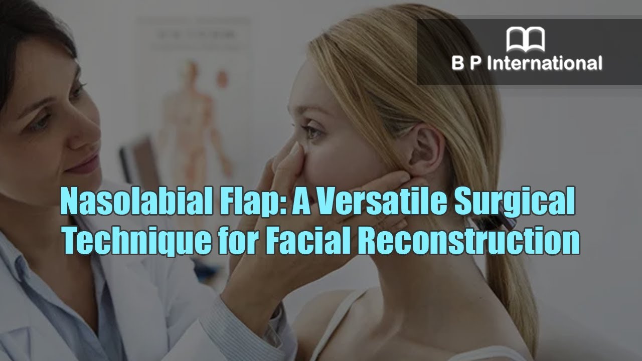 Nasolabial Flap: A Versatile Surgical Technique for Facial ...