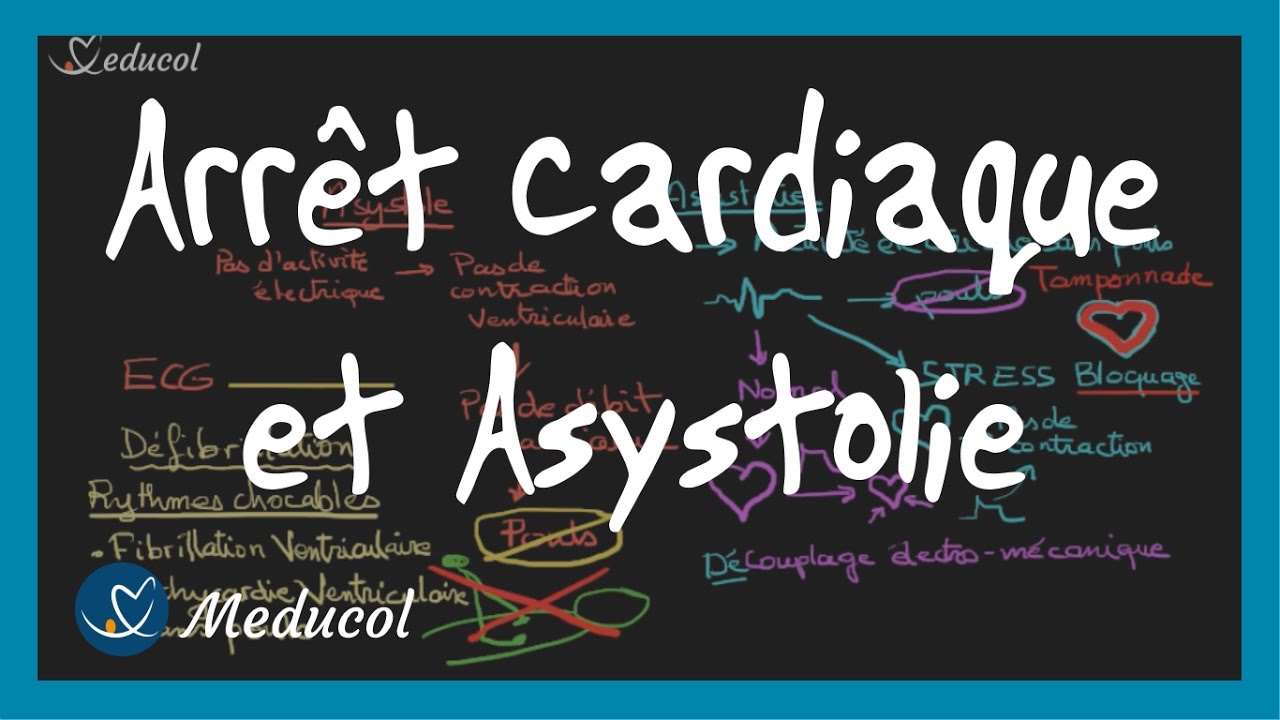 Arrêt cardiaque et Asystolie: ECG, causes et traitement (ictal) - YouTube