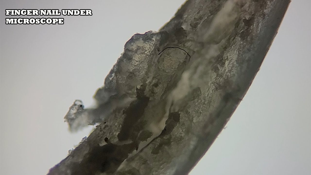 Fingernail under a microscope - YouTube