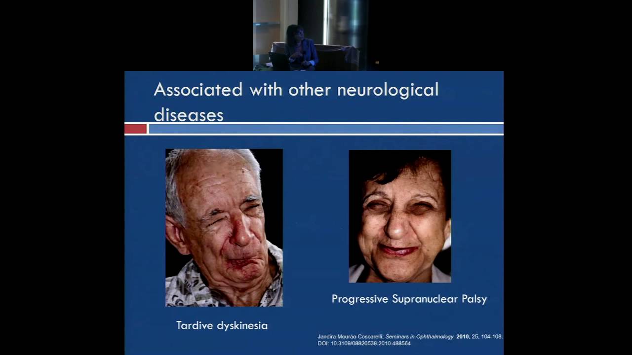 Overview of Blepharospasm and Other Neurological Eye Disorders - YouTube