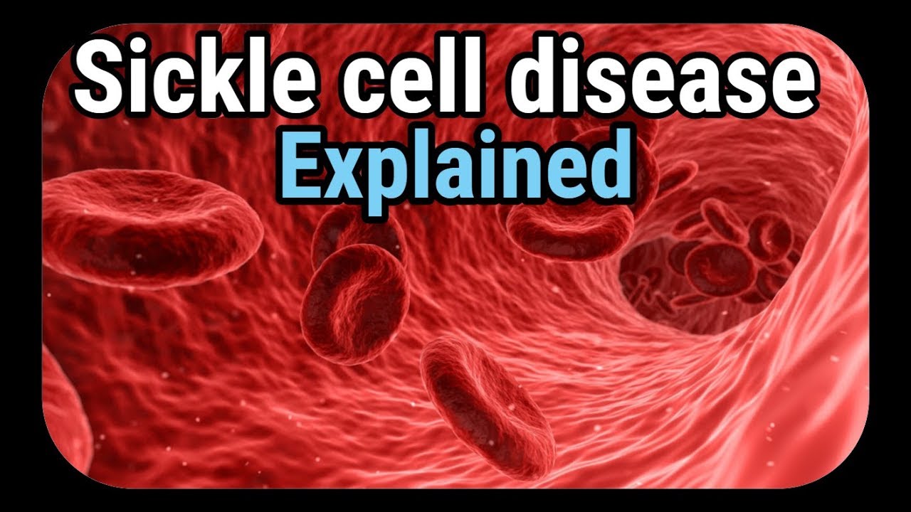 Sickle cell disease explained | How it is caused? - YouTube