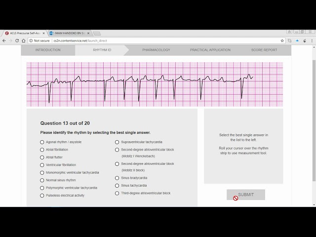 Acls Precourse Self Assessment Rhythm Identification Hotsell | www ...