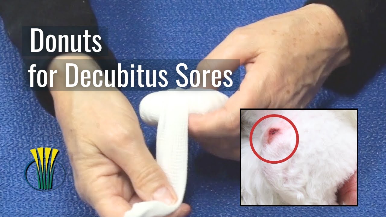 Padding with Purpose: Donuts for Decubitus Sores. - YouTube