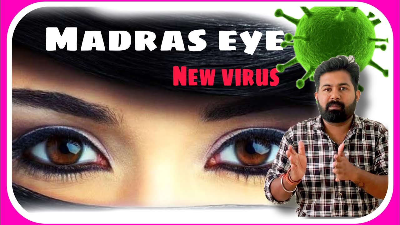 Madras Eye | conjunctivitis | Malayalam | Vinod Radhakrishnan - YouTube