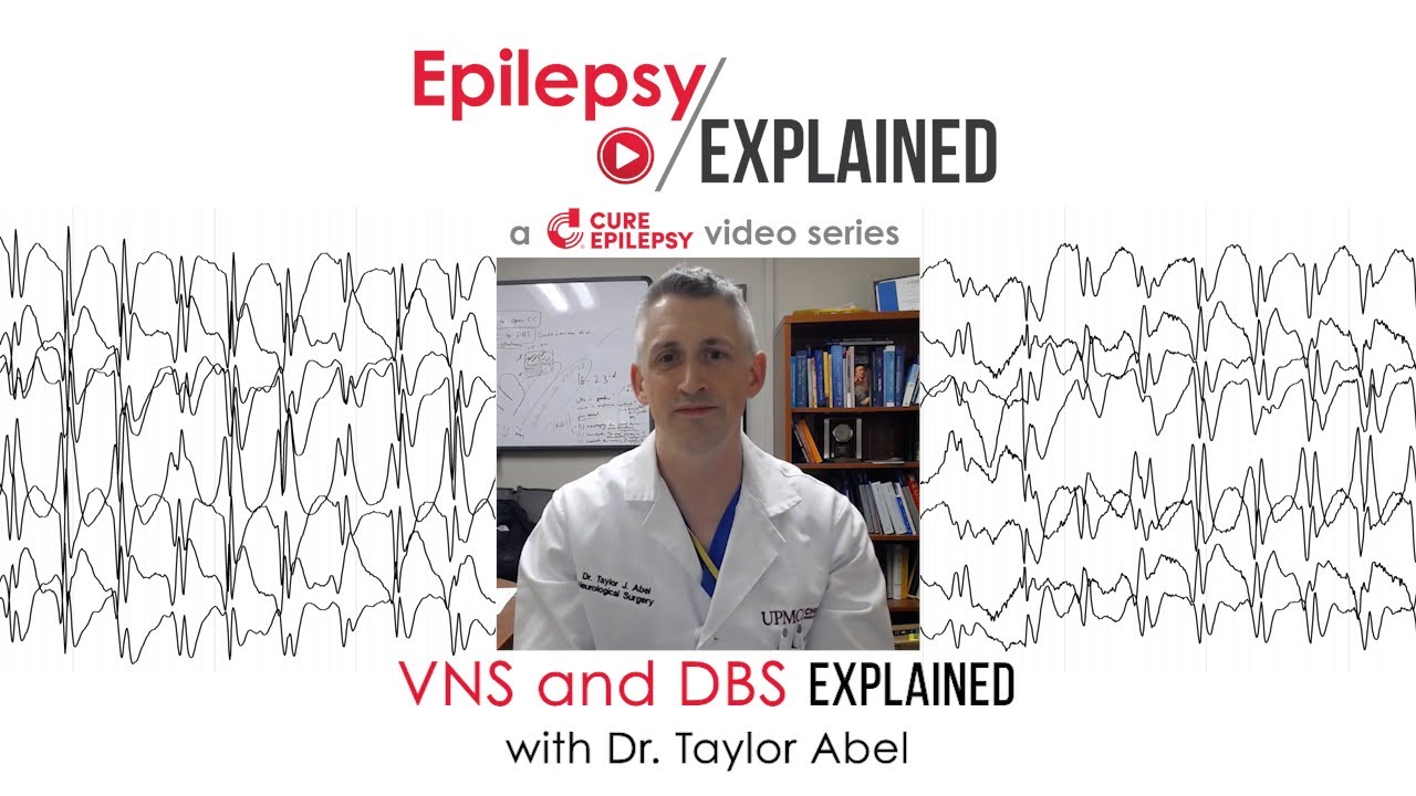 VNS and DBS for Epilepsy: When to Consider Neurostimulation Devices and ...