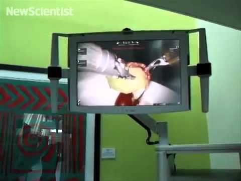 Doctor uses surgical robot to skin a grape - YouTube
