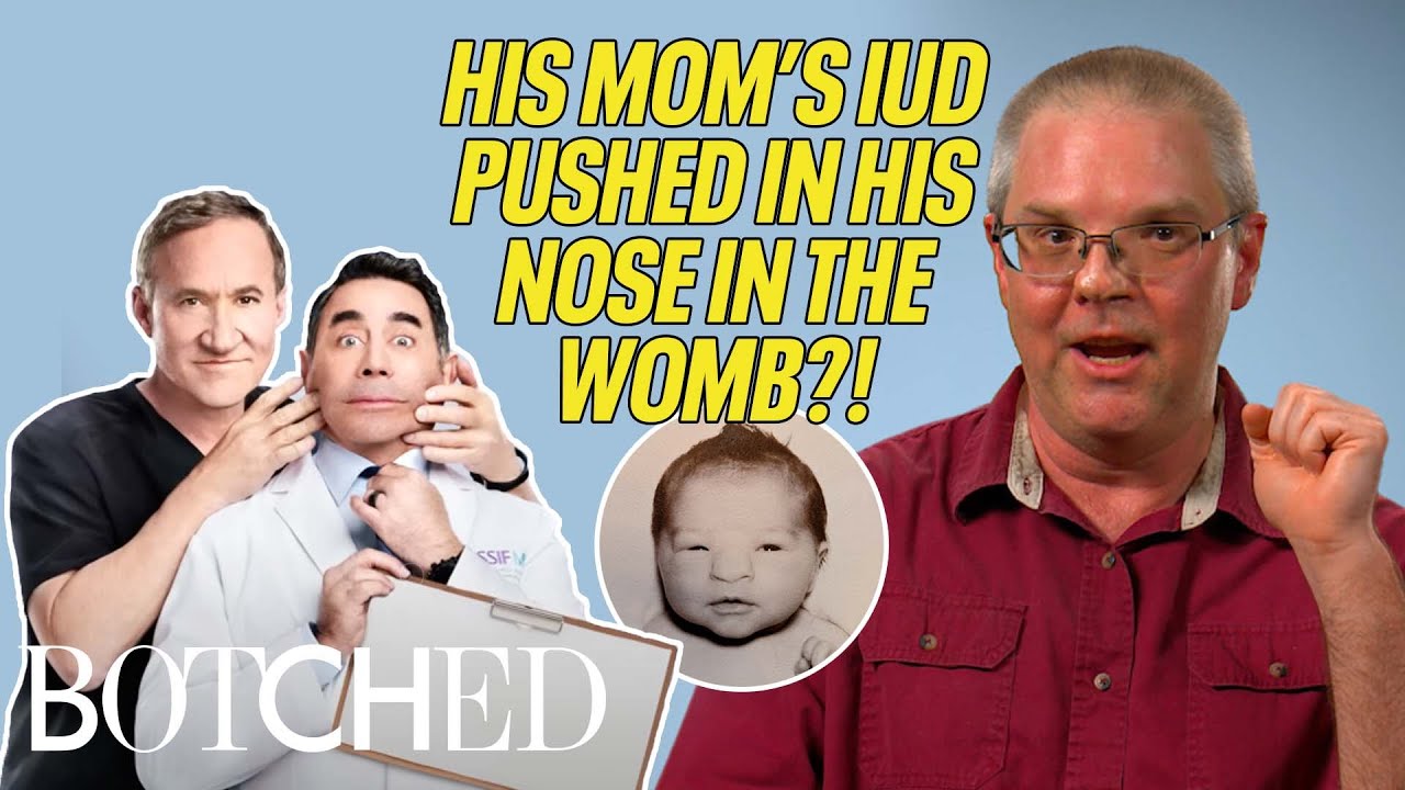 David's Nose Was Damaged By His Mom's IUD Before Birth?! (Before ...