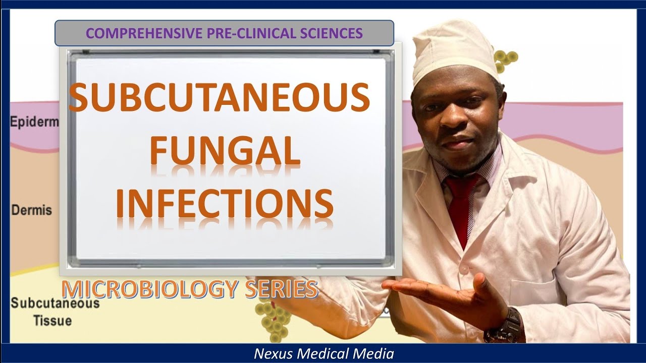 SUBCUTANEOUS FUNGAL INFECTIONS - YouTube