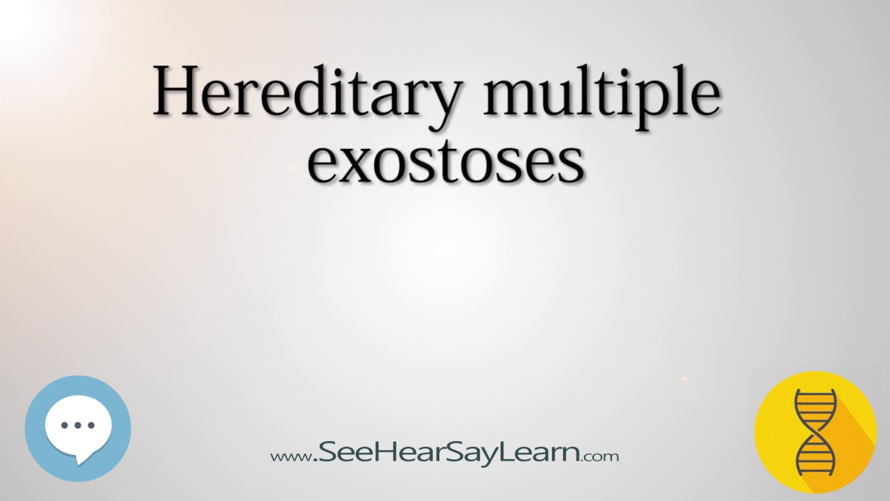 Hereditary multiple exostoses 🔊 - YouTube
