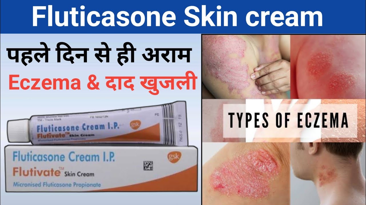 flutivate skin cream | flutivate skin cream uses in hindi |fluticasone ...
