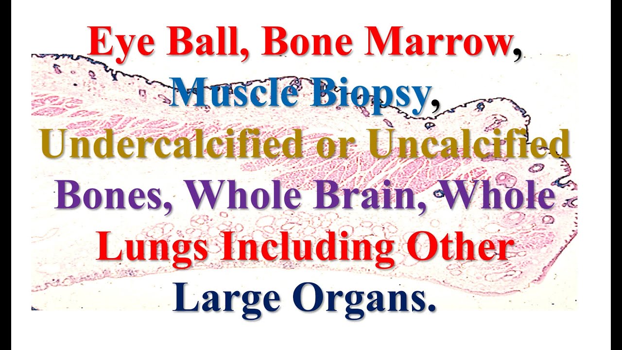 #Eye Ball #Bone Marrow #Muscle Biopsy #ndercalcified or Uncalcified # ...