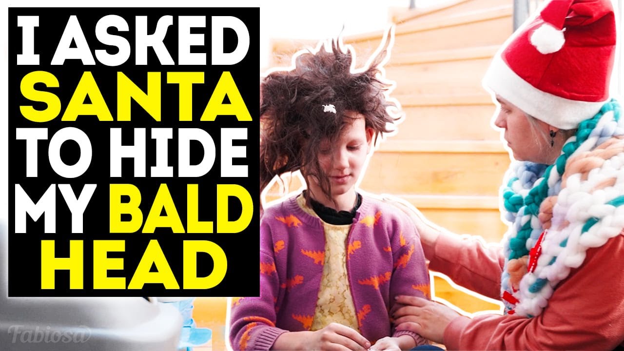 I asked Santa to hide my bald head - YouTube