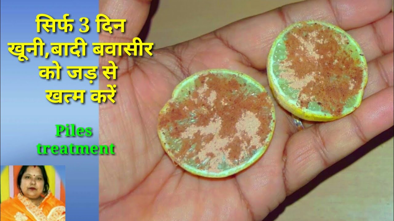 सिर्फ 3 दिन बवासीर को जड़ से खत्म कर देगा हमेशा के लिए /Piles treatment ...