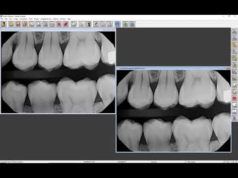 VixWin Platinum 3.5 - Acquiring Images in the Windows Layout View - YouTube