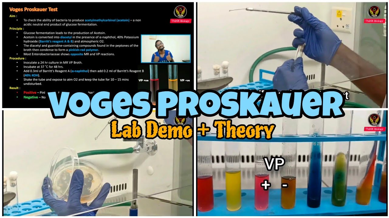 Voges Proskauer | Biochemical Test | Lab Demo | Tamil | Microbiology ...